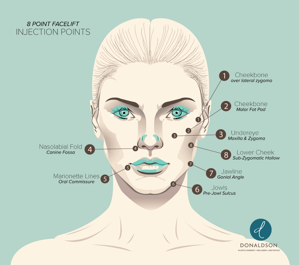 Facelift Acupressure Points Diagram How To Carry Out A Respiratory